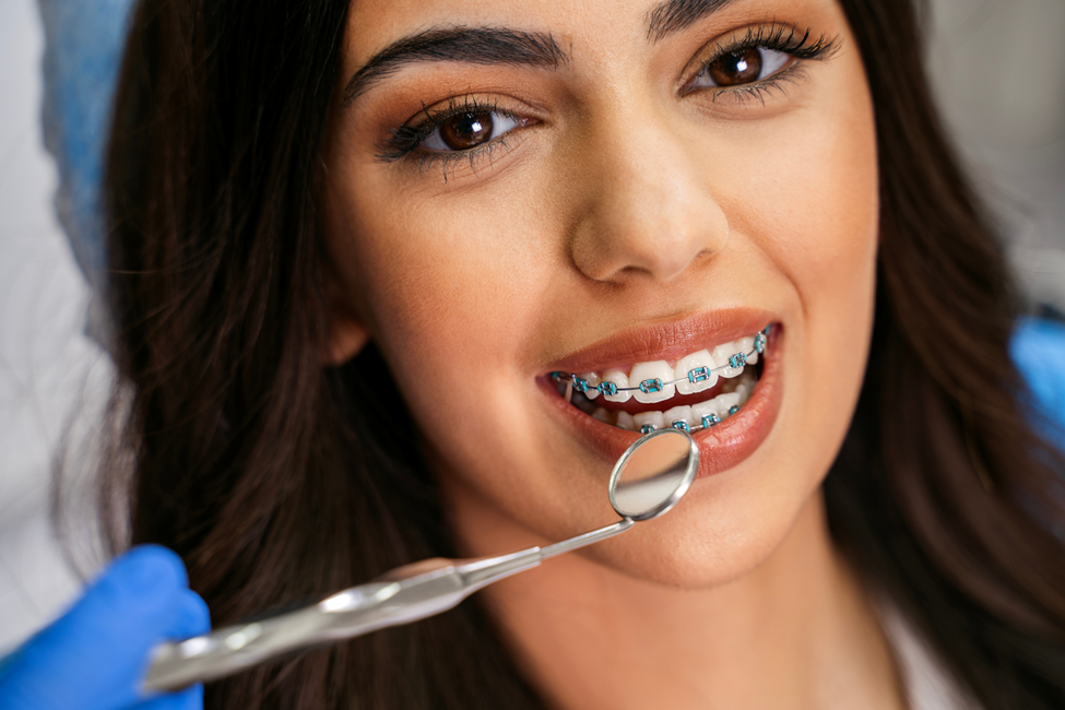 How Long Will I Need to Wear Braces? | Simply Orthodontics